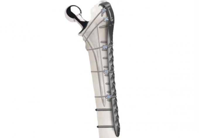 1.0mm 1.3mm 1.7mm Crimp Orthopedic Cable System Grey Silver