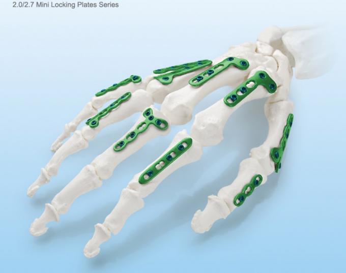 Metacarpal T Plate Orthopedics