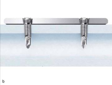 Ulna Radius Dcp Dynamic Compression Plate Ortho Class IIb