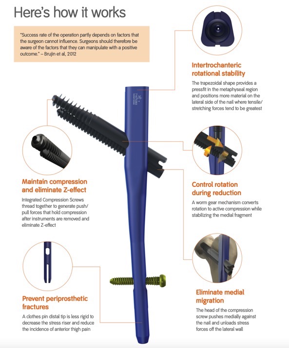 Femoral Gamma Intramedullary Nail System Intertan Nail II 9.4mm 11mm 12mm