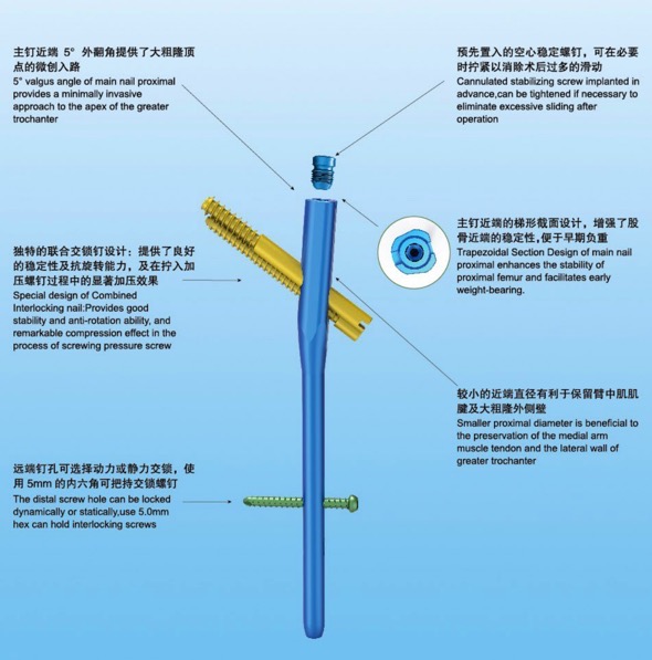 Femoral Gamma Intramedullary Nail System Intertan Nail II 9.4mm 11mm 12mm