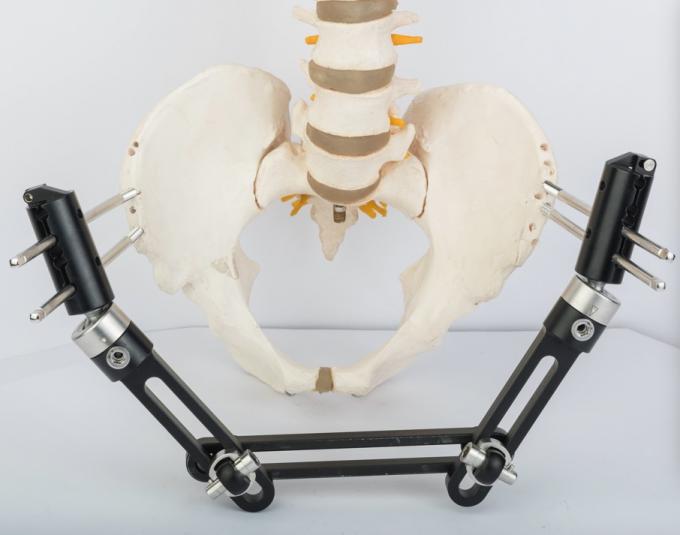 Surgical Orthopedic External Fixator T Type For Pelvic Fractures