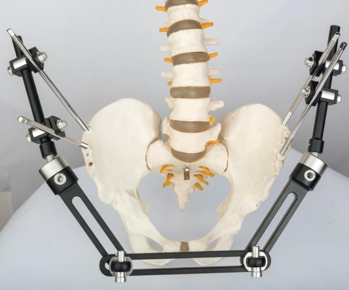 Surgical Orthopedic External Fixator T Type For Pelvic Fractures