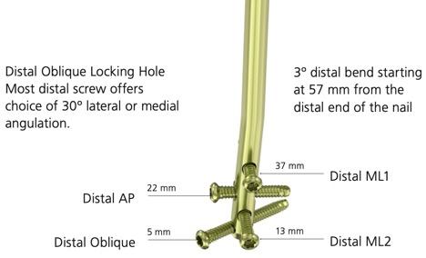 Tibial Intramedullary Interlocking Nail Titanium Orthopedic Implant